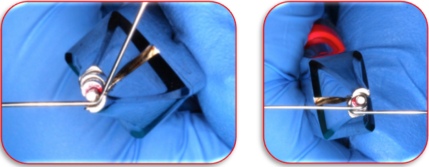 June's Tip: Orthodontic Loops in Straight Wire System Part 1 ...