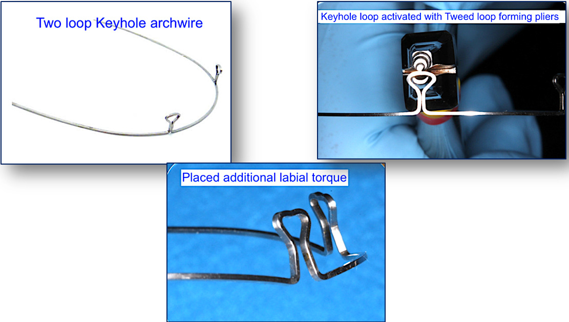 Decembers Tip Prefabricated Posted And Keyhole Mushroom Looped Arch