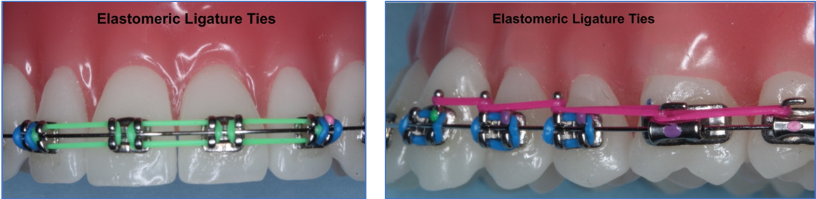 March's Tip: Peripherals in Straight Wire System Back to Basics Part II ...