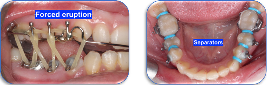 October's Tip: Peripherals in Straight Wire System Back to Basics Part ...
