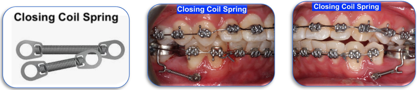 March's Tip: Peripherals in Straight Wire System Back to Basics Part ...