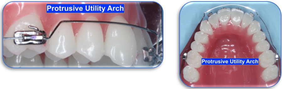 August's Tip: The Utility, Part II - International Association for ...