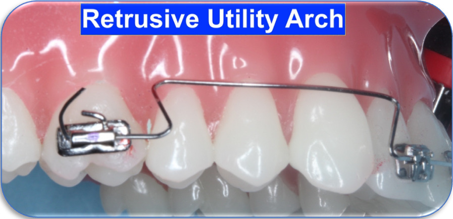 August's Tip: The Utility, Part II - International Association for ...